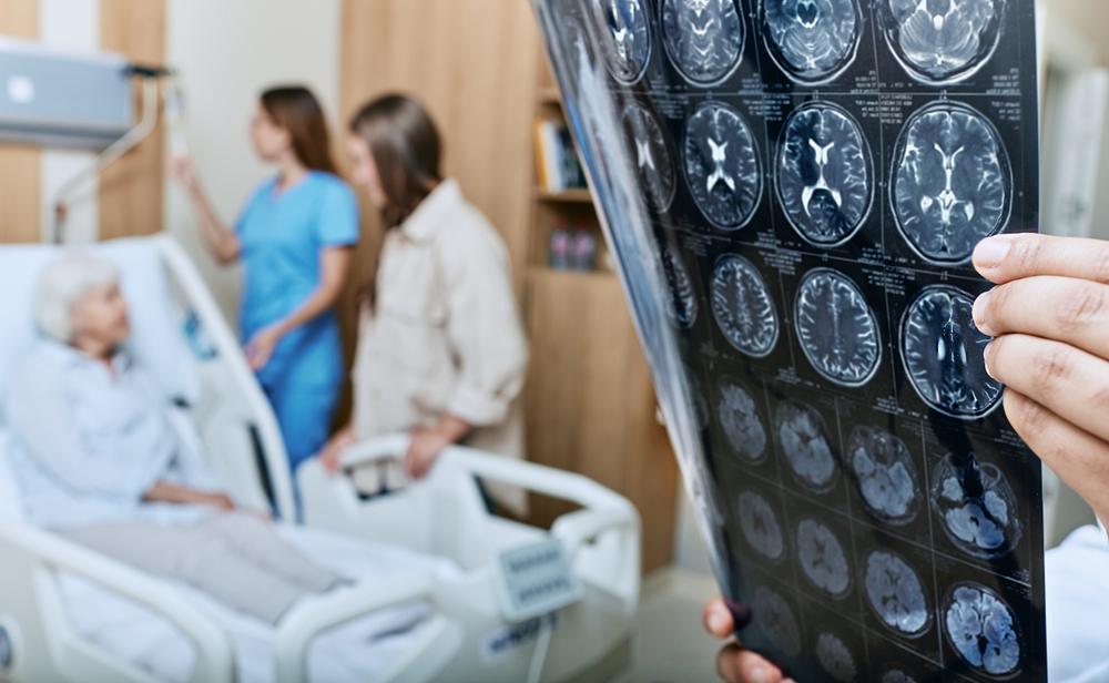 What Is Functional Neurological Disorder 